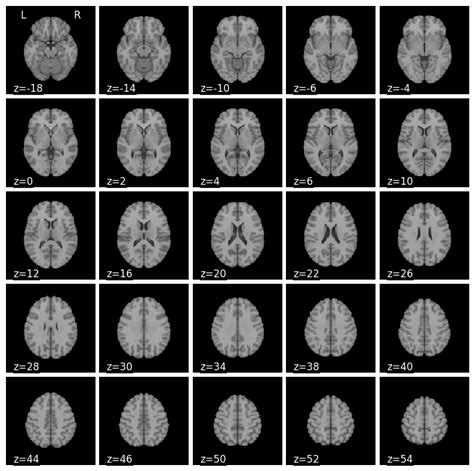 How To Organize Axial Slices In Nilearn Plotanat Neuroimaging