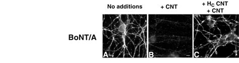The Recombinant Hc Fragments Of Bonta B And E Block The