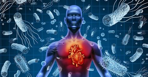 Staphylococcus Aureus Endocarditis A Selection Of…