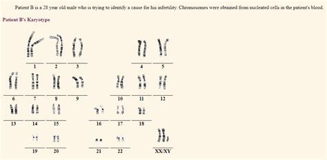 Solved Interpreting The Karyotype Lab Technicians Compile