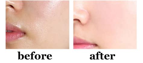 Ghk Cu Before And After See Fine Lines And Wrinkles Fade Fast