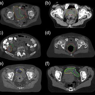 A Diagram Demonstrating The Data Acquisition Process For Automatic Download Scientific