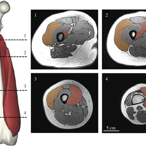 Individual Example Of Muscle Segmentation And Muscle Volume Download Scientific Diagram