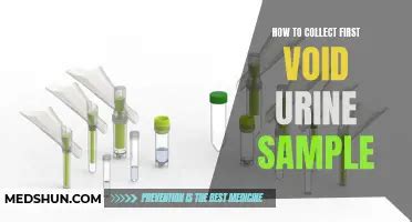 Collecting Midstream Urine Samples A Step By Step Guide Medshun
