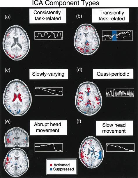 Figure 1 From Spatially Independent Activity Patterns In Functional Mri Data During The Stroop