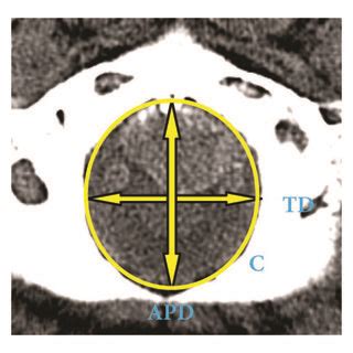 Cranial Base Demonstrating The Foramen Magnum Measurements Download
