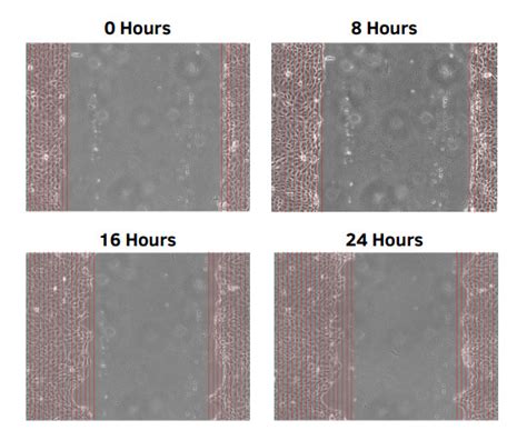 Bayesian Inverse Problem For A Fractional Diffusion Model Of Cell Migration