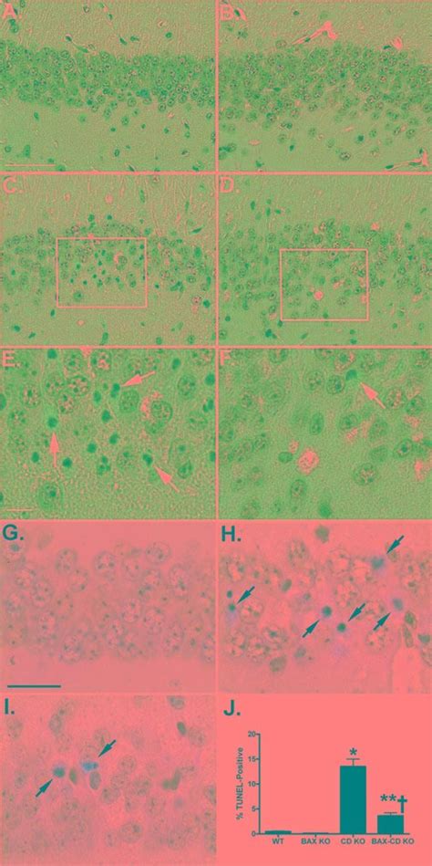 Targeted Bax Deletion Provides Partial Protection Against Cd Download Scientific Diagram
