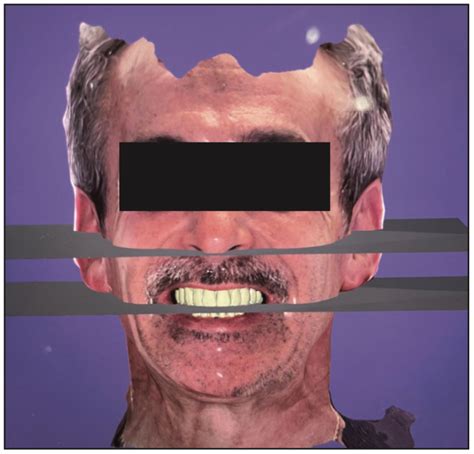 Three Dimensional Facial Scanning A New Paradigm Dentistry Today