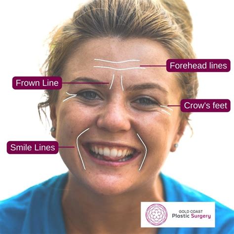 What Procedure Is The Surgical Removal Of Wrinkles Flash Sales