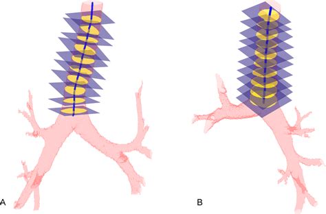 skeletonization process of the trachea three dimensional download