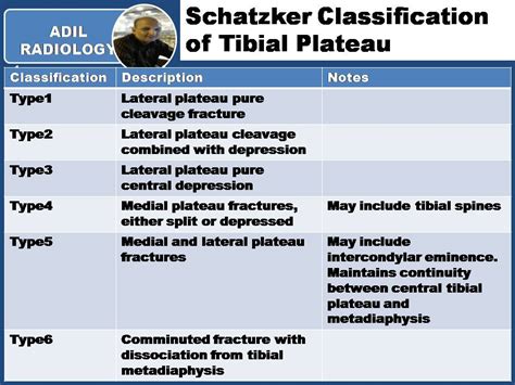 Schatzker Classification Of Tibial Radiology Classroom Facebook