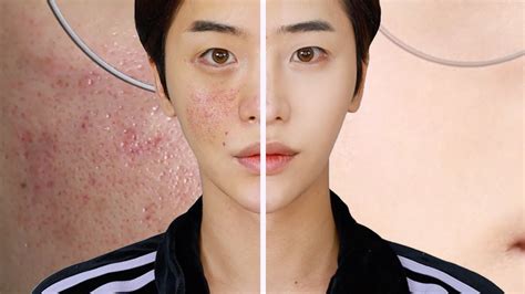 Eng 광고 즉석에서 바뀌는 홍조 트러블 피부 커버 메이크업 Jerome 제롬 Youtube