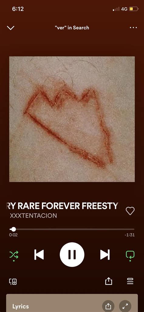 Anyone Know What This Heart Crown Thing Is Supposed To Resemble R