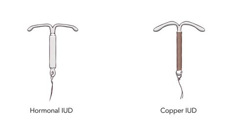 Intrauterine Devices Iuds Pro Medic Clinic Healthcare Clinic