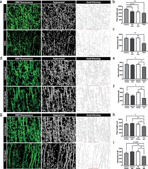 Segmentation Of Mbp Staining Allows Detailed Analysis Of Download