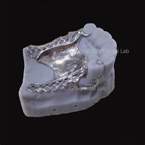 Customized Metal Framework Make Of Cobalt Chromium Alloy Or Pure Titanium With High Strength