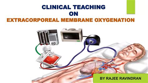 Ecmo Extracorporeal Membrane Oxygenation Pptx