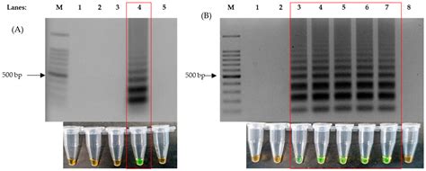 Multiplexed Reverse Transcription Loop Mediated Isothermal Amplification Coupled With A Nucleic