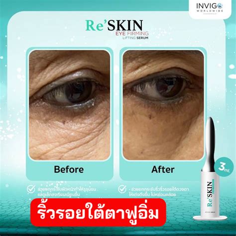 Reskin รีสกิน [ของแท้100 ] ครีมทาถุงใต้ตา ริ้วรอย ตีนกา กระชับตั้งแต่ครั้งแรก Line Shopping