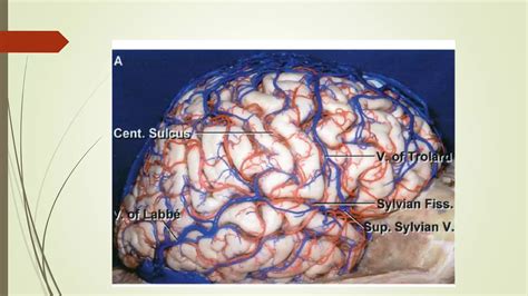 Venous Anatomy Of The Brain Pptx