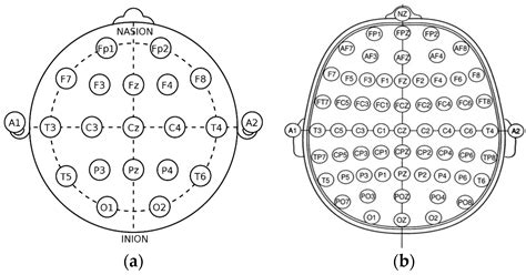brain age prediction classification through recurrent deep learning