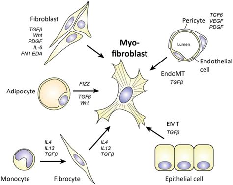 Unraveling Ssc Pathophysiology The Myofibroblast Pmc