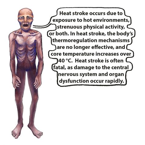 Heat Heart Concrete The Body Is Permeable Human Health In Times