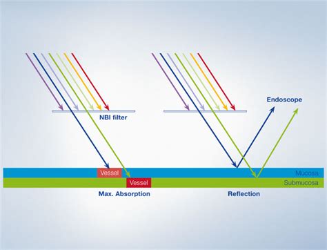 Narrow Band Imaging Nbi In Urology Olympus