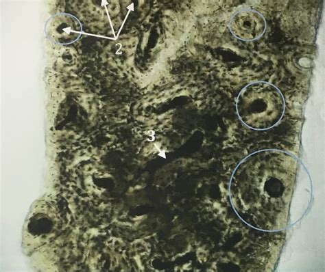 Compact Bone 100x Diagram Quizlet
