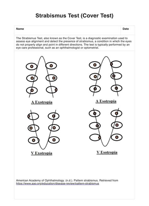 Strabismus Test