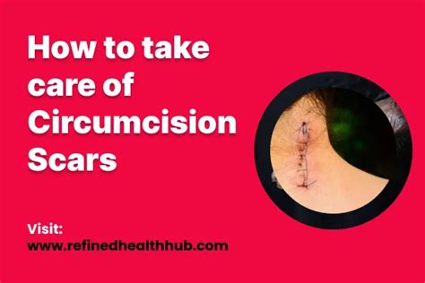 How To Take Care Of Circumcision Scars 2026 Refined Health Hub