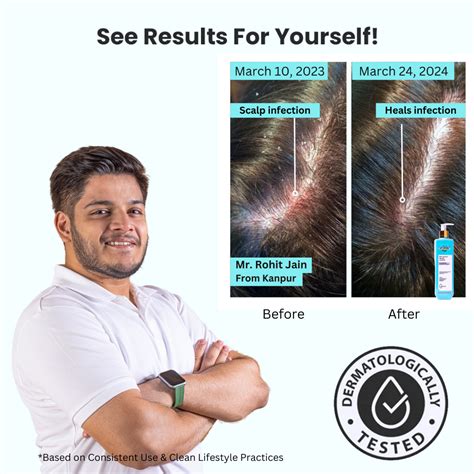 Dry Scalp Relief Lotion 300 Ml