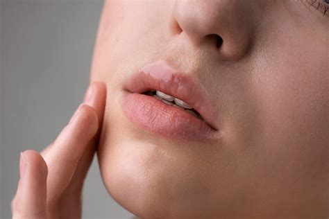 Causes Of Lip Dryness Why Your Lips Feel Dry And How To Treat It