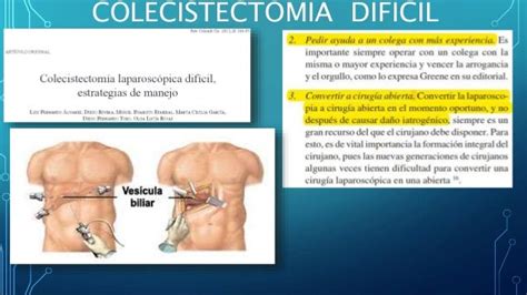 Colecistectomia Abierta Y Laparoscopica