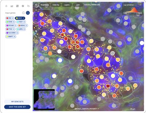Bioturing Lens Spatial Omics Analytics Platform