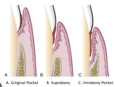 CSCE Retake Practice Qs Flashcards Quizlet CSCE Retake Practice Qs Flashcards Quizlet