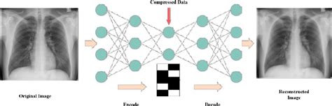 Figure 2 From Development Of Automated Diagnostic Tools For Pneumoconiosis Detection From Chest