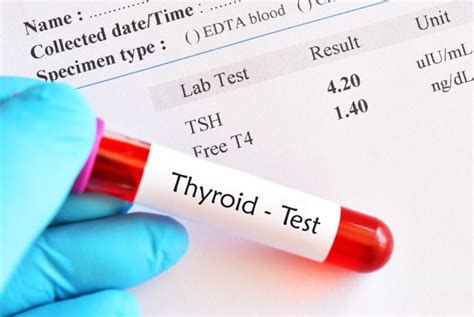 Thyroid Test Complete Guide Symptoms Diagnosis Nayab Labs
