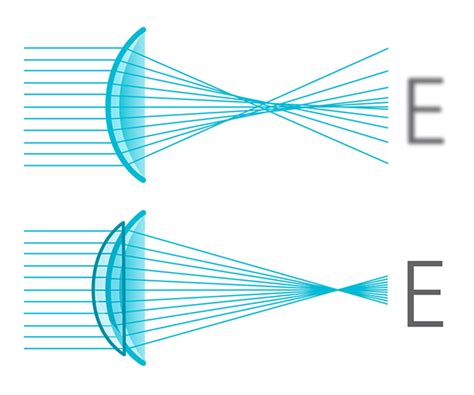 Aberration Neutralizing System™ Coopervision