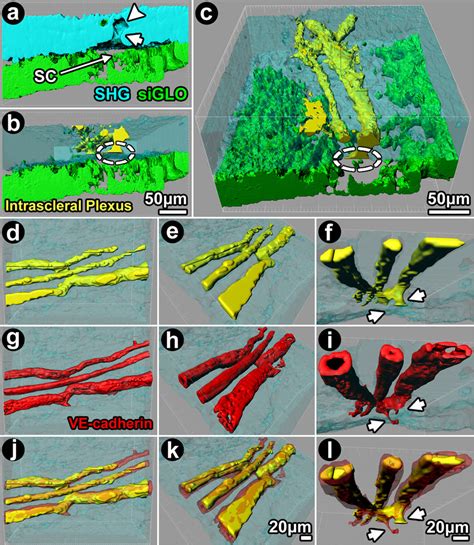 Isosurface Mapping And 3 Dimensional Reconstruction Of Distal Aqueous Download Scientific