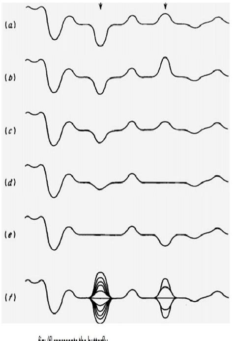 Figure 22 Implementing And Working Of Mti Radar Using