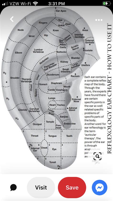 Topography And Indications Of Auricular Acupuncture Points According To