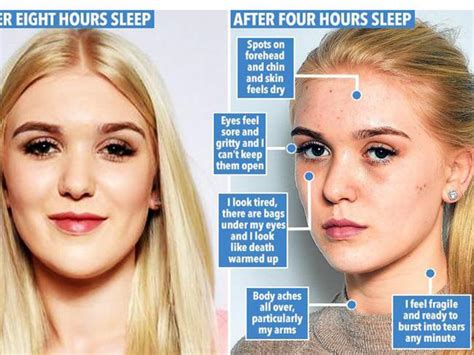 The Damaging Effects Of Sleep Deprivation Au — Australias