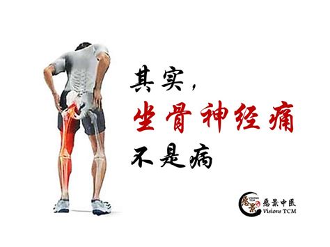 其实，坐骨神经痛不是病【颜伟龙中医师】 愿景中医 Visions Tcm
