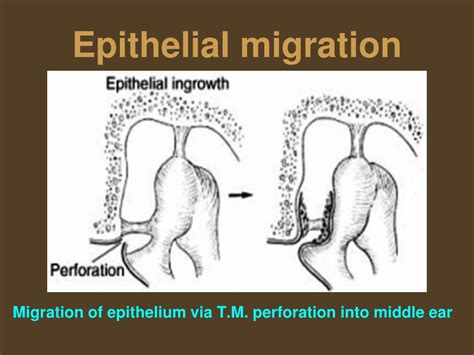 Ppt Csom Clinical Features Powerpoint Presentation Free