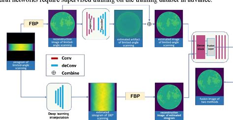 Figure 1 From Sparse View Ct Reconstruction Based On Fusion Learning In