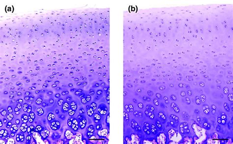 Articular Cartilage Histology