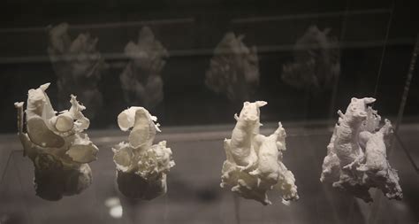 심장과 혈관 질환 선천성 심장병 선천성 심장병의 종류