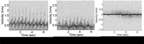 U Doppler Signature With Azimuth Angles Of 0 45 And 90 Degrees